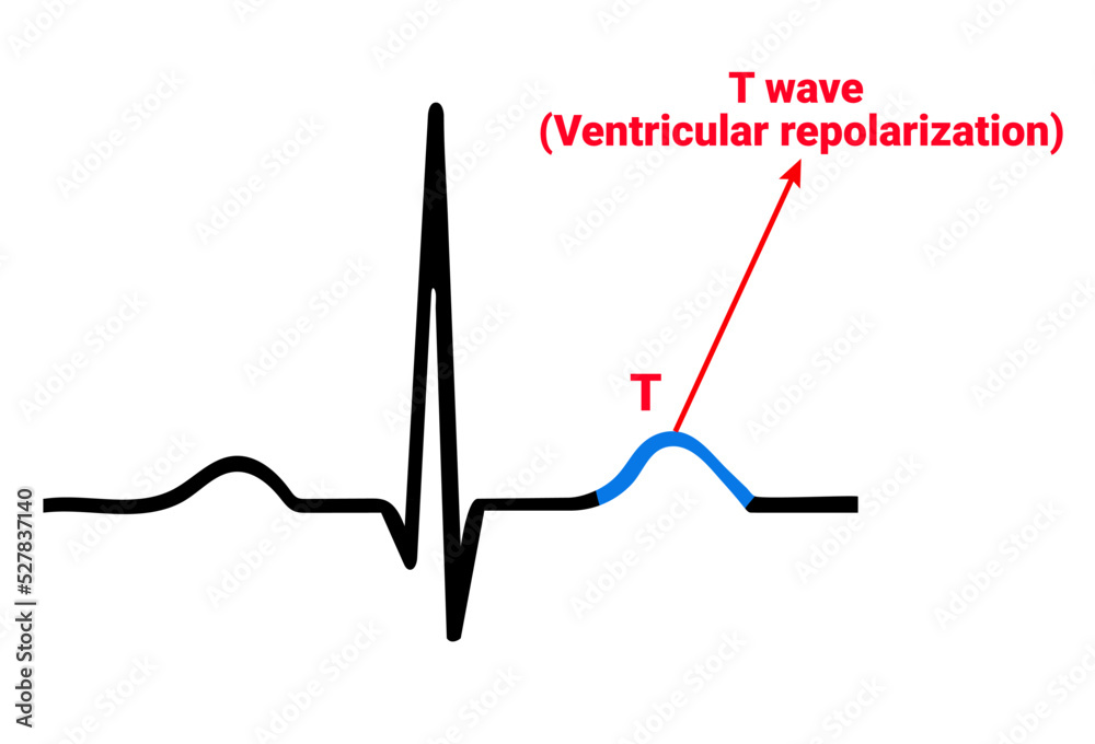 Structure of T wave (Ventricular repolarization) Stock Vector | Adobe Stock