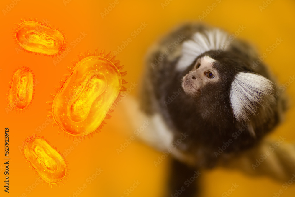 Monkeypox concept. Monkeypox is a viral zoonotic disease. MPXV virus ...