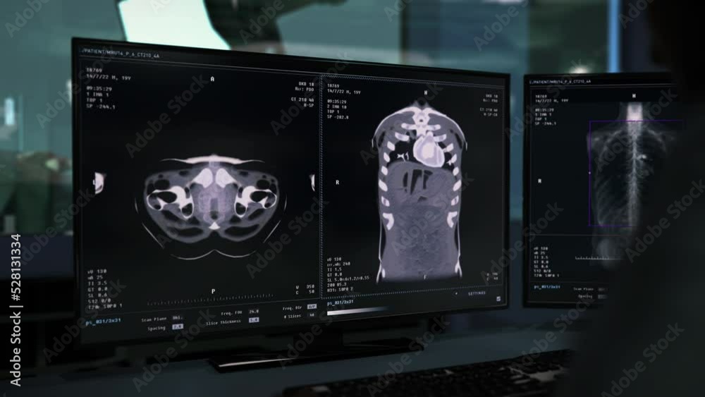 Doctor Uses Medical Machine To Analyze Internal Organs For Health ...