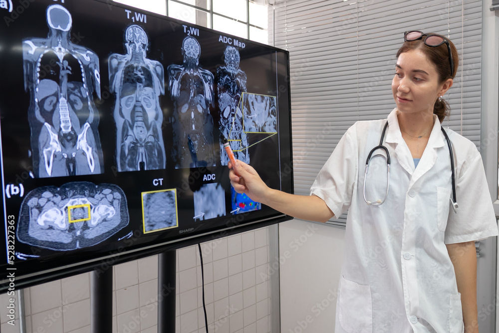 Female doctor check film x-ray image for patient medical care. Surgeon ...