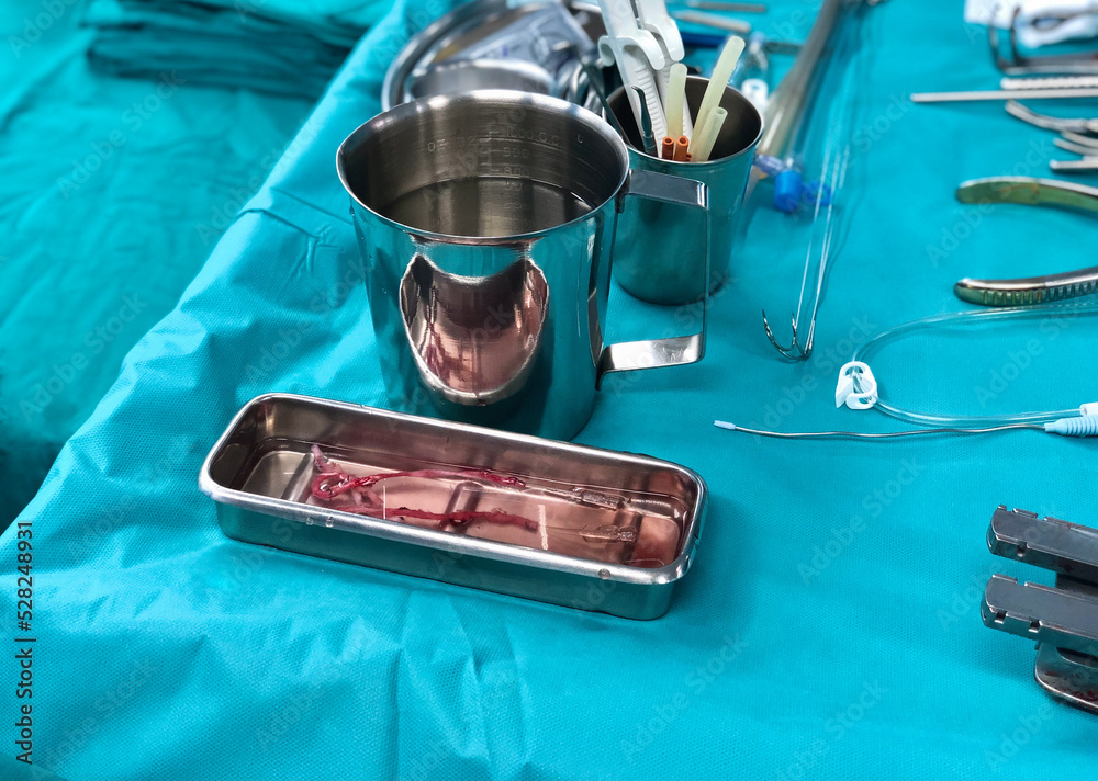 Medical equipment and saphenous vein graft (SVG) for open heart surgery ...