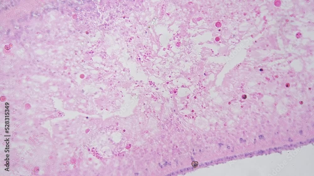 Microscopic footage of Planaria in transversal section 200x filmed on ...