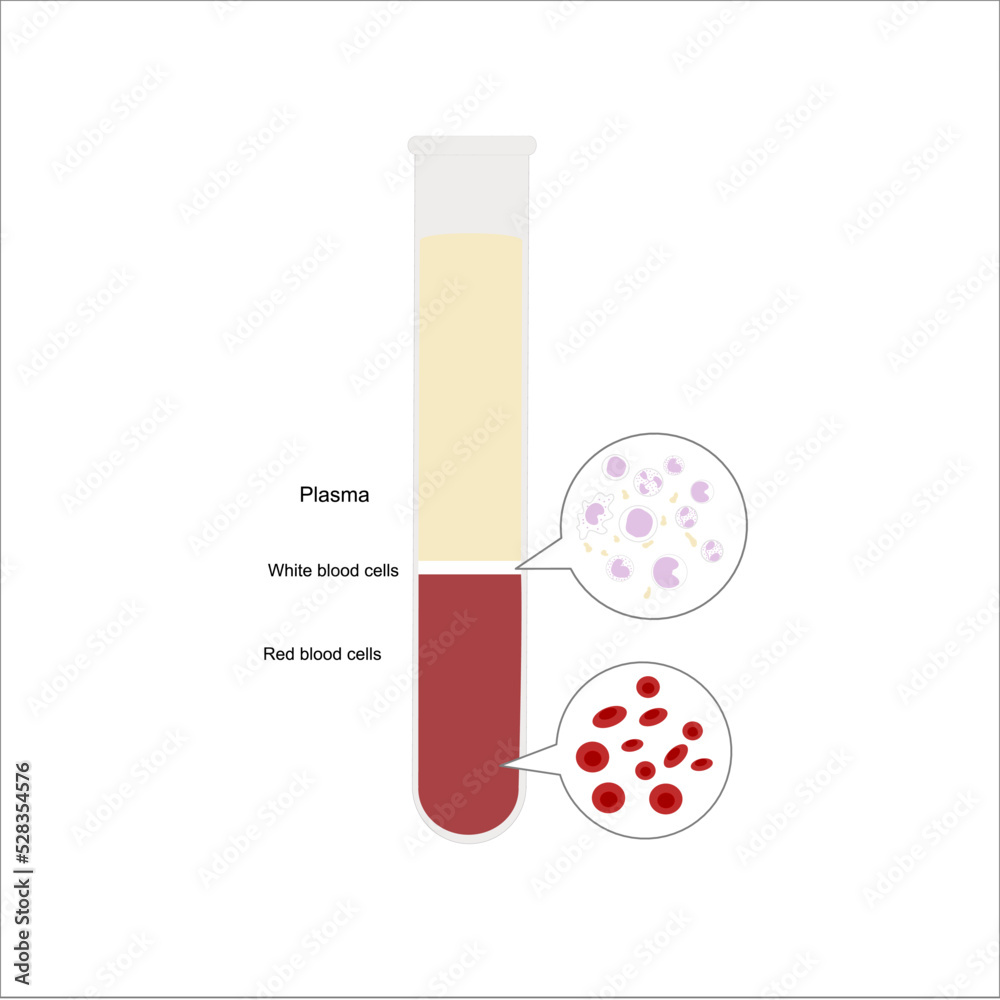 Plakat The peripheral or whole blood sample in test tube were separated ...