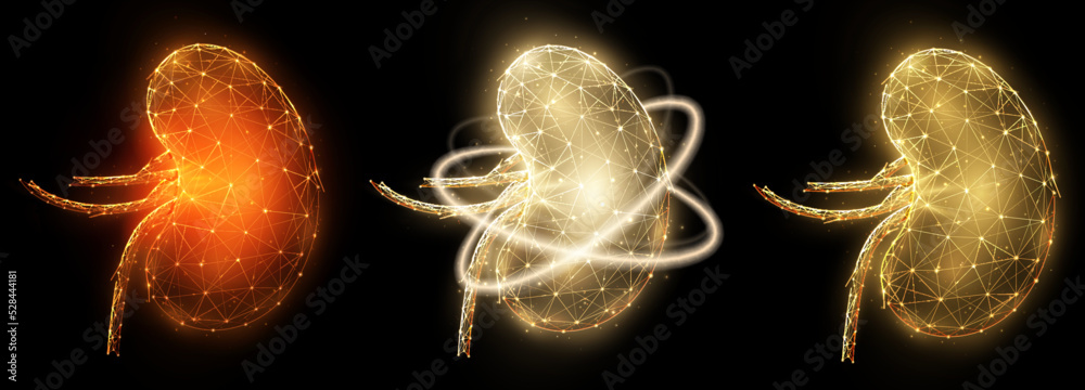 Polygonal vector illustration of inflamed diseased kidney, healthy ...