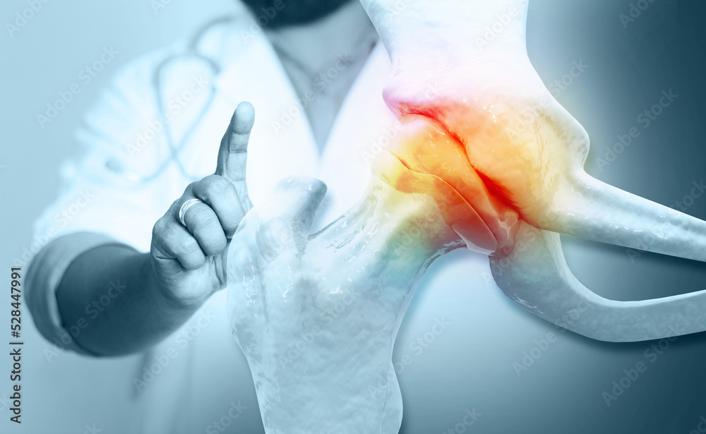 Doctor check and diagnose the Shoulder painful skeleton on medical ...