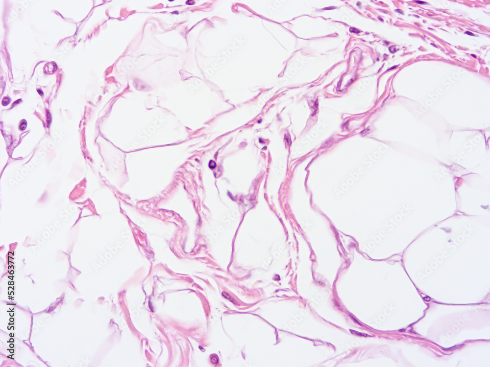 Histology of human tissue, show epithelial tissue and connective tissue ...