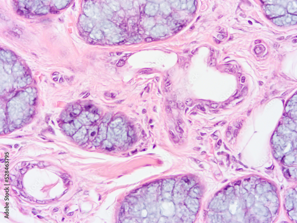 Histology of human tissue, show epithelial tissue and connective tissue ...