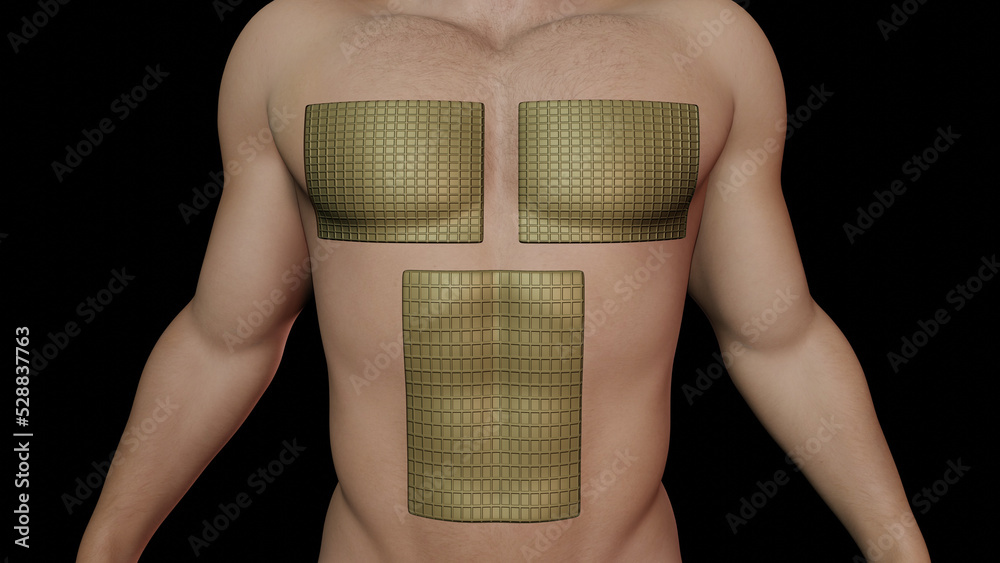 Biosensor , Bioelectronics on skin . Medical sensors on skin. Wearable ...