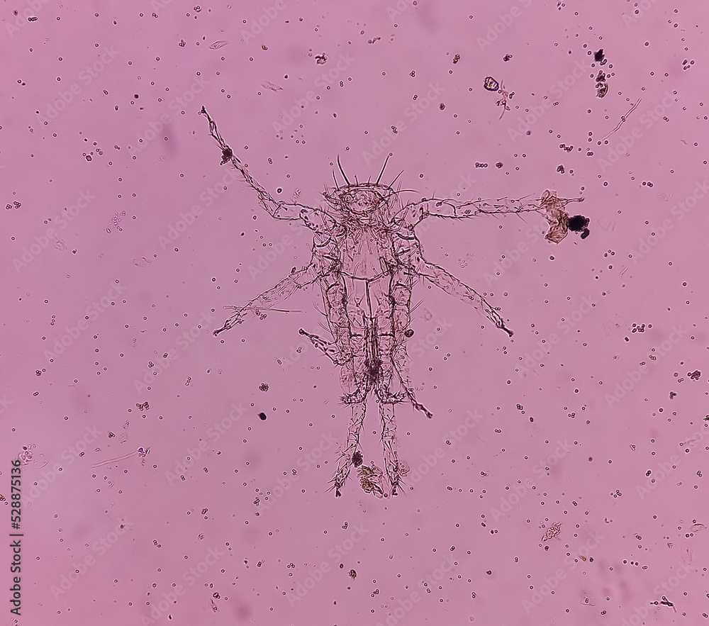 Cyclops Under Microscope