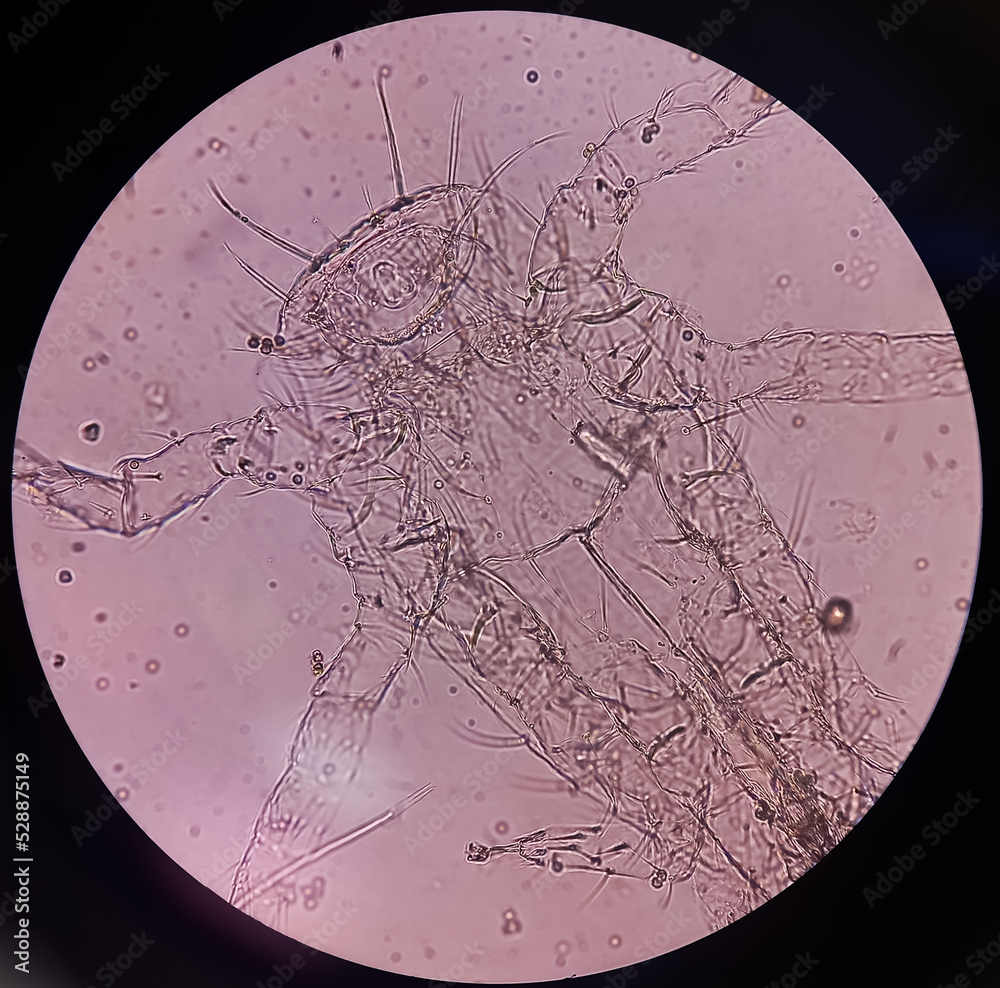 Copepod Cyclops is small crustacean found in freshwater pond ...