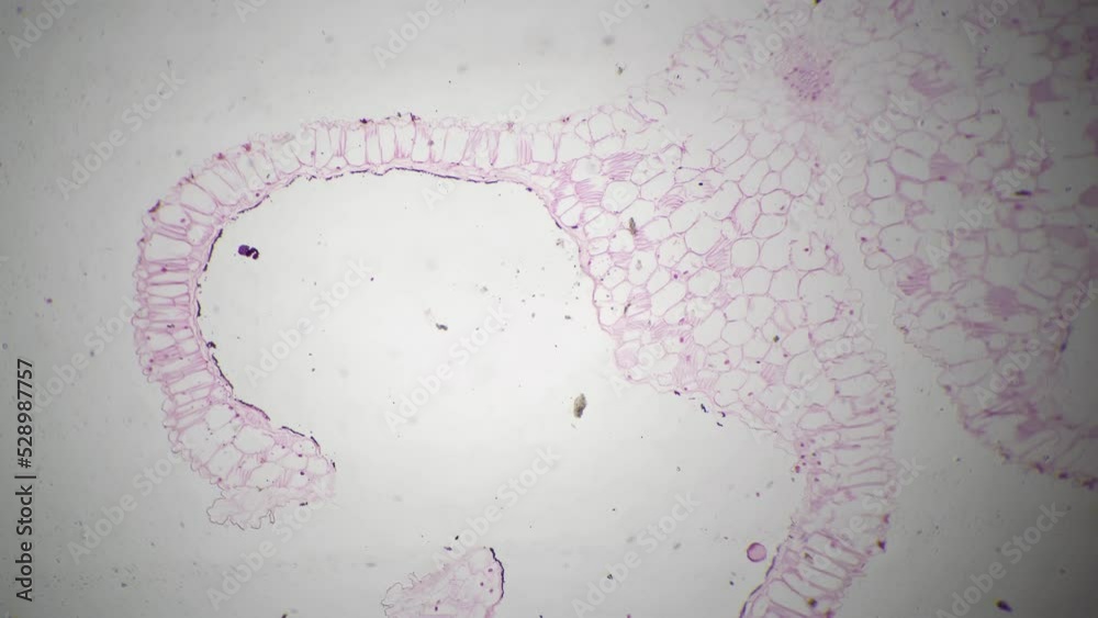 Lilium matuer anther in transversal section under microscope 40x on ...