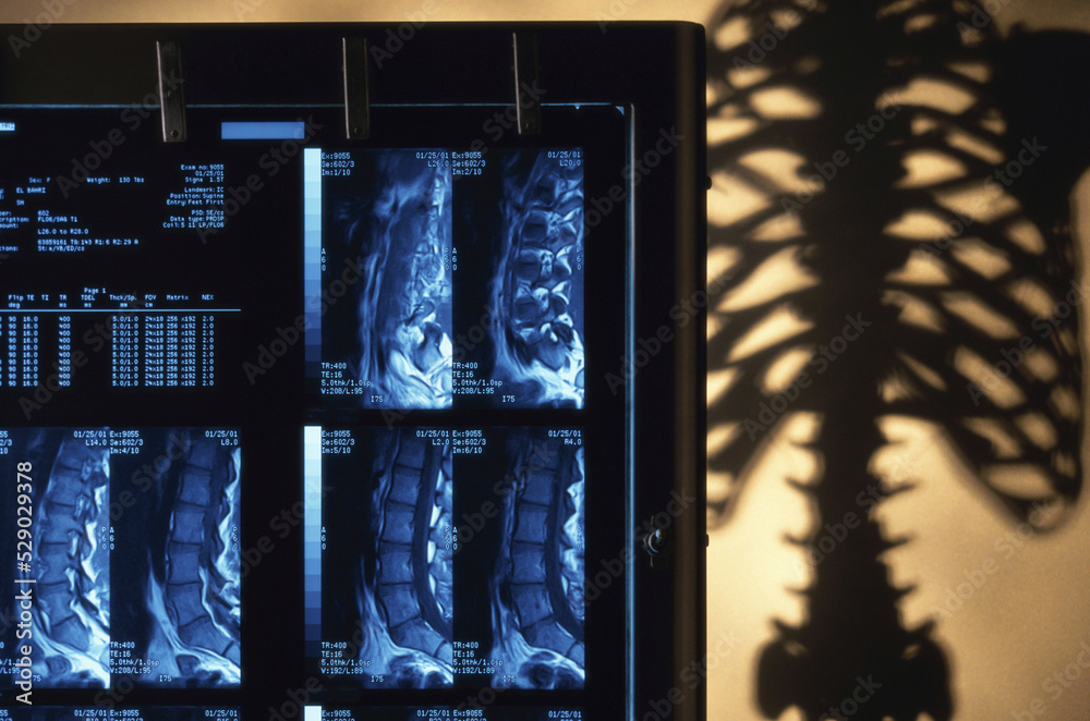 Scans of human spinal cord Stock Photo | Adobe Stock