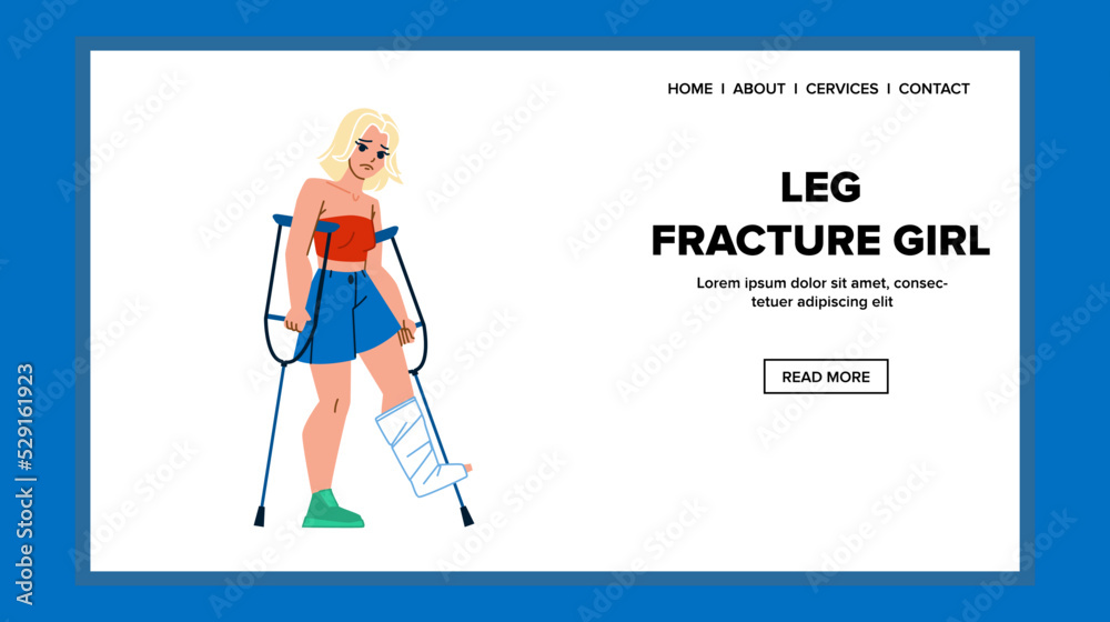 leg fracture woman vector. broken bone, person accident, foor cast leg ...