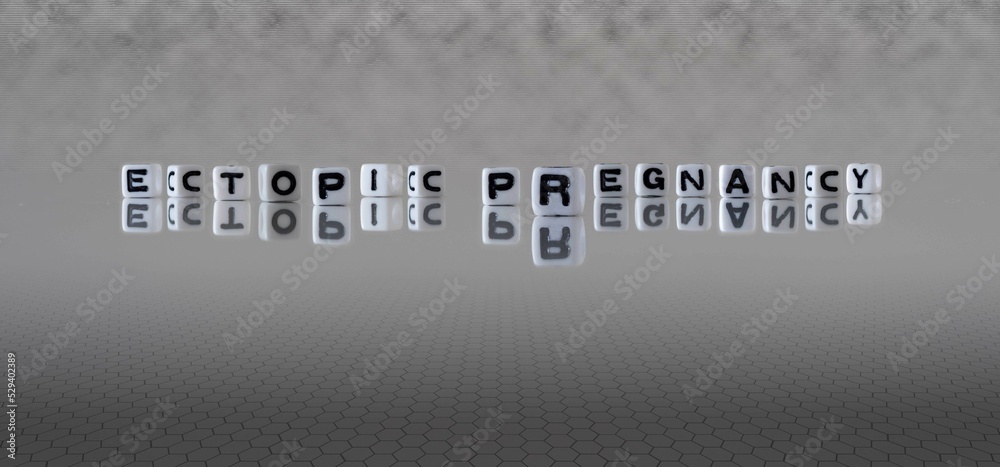 ectopic pregnancy word or concept represented by black and white letter ...