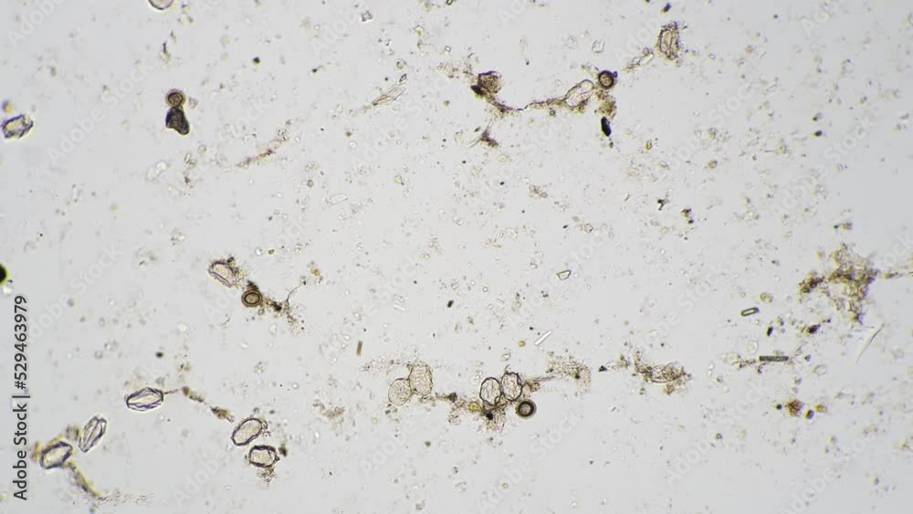 Video Stock Whole mount of Taenia solium eggs under microscope on white ...