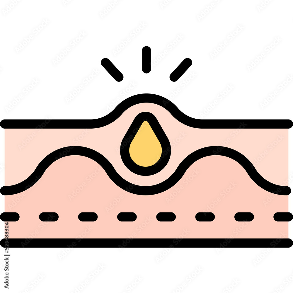 Acne icon. Filled outline design. For presentation. Stock Illustration ...