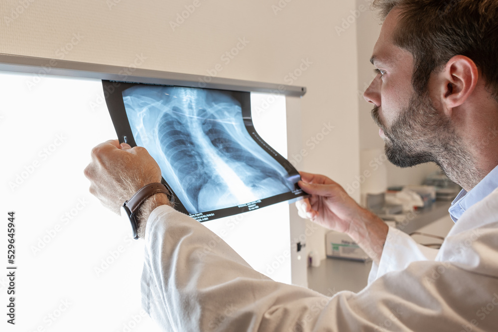 pulmonologist Doctor looks at a chest x-ray - clinic medical concept ...
