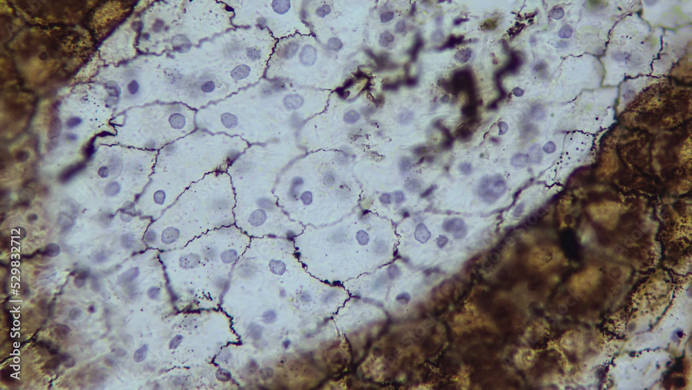 Plakat Simple squamous epithelium (mesothelium). Epithelium that lines ...