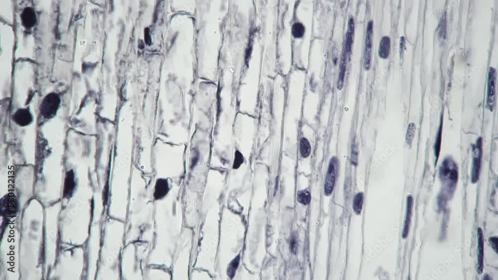Macro of Allium cepa root tip in longitudinal section 400x against ...