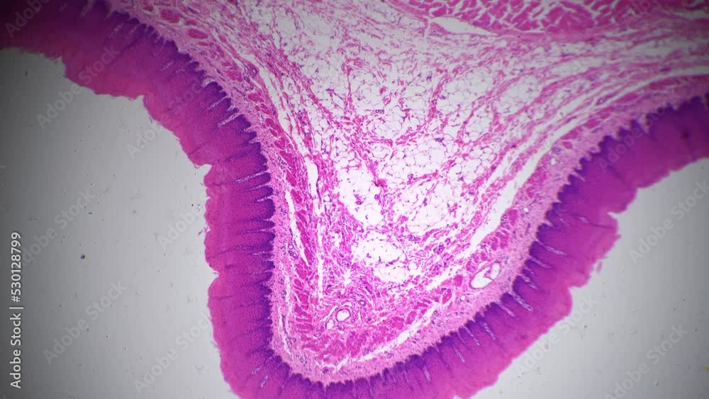 Stratified squamous epithelium in section filmed by microscope 40x ...
