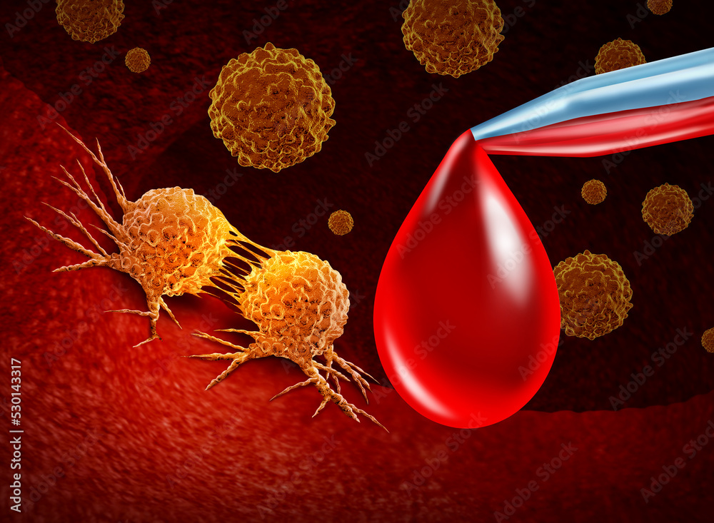 Cancer screening and blood test for early detection of malignant cells ...