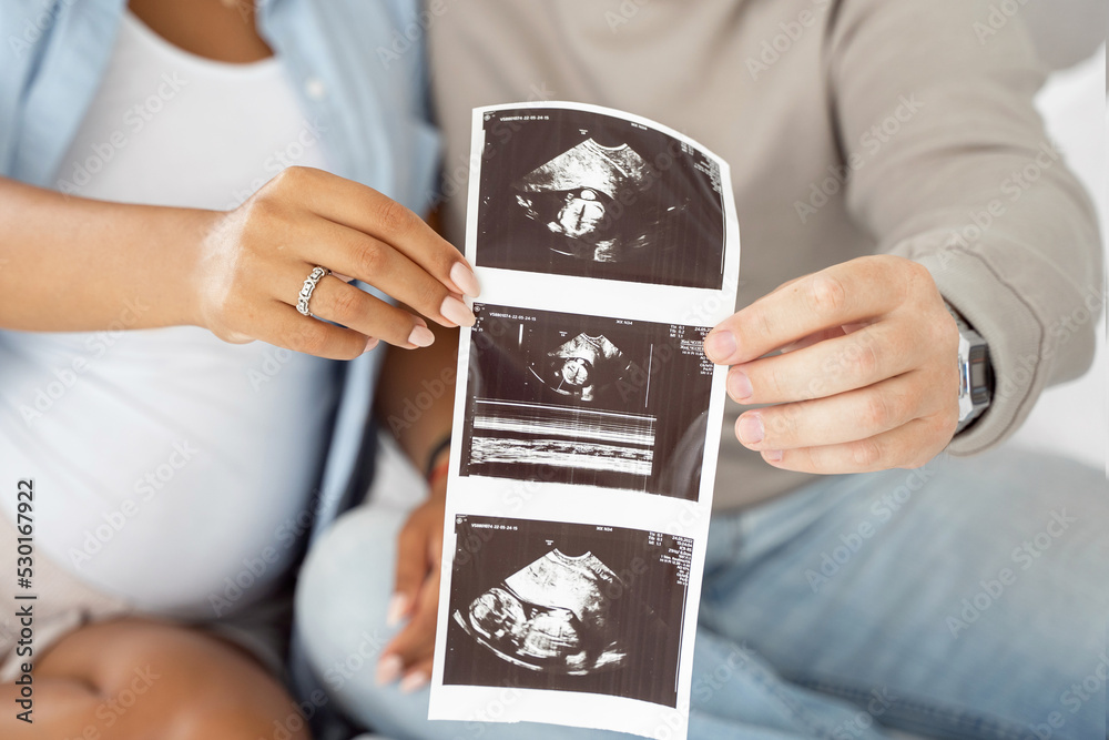 Foto de Closeup multiethnic pregnant couple demonstrate baby sonography ...