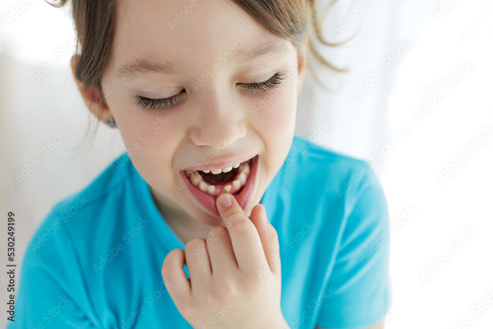 The child has lost a tooth. Little girl without a tooth. The first ...