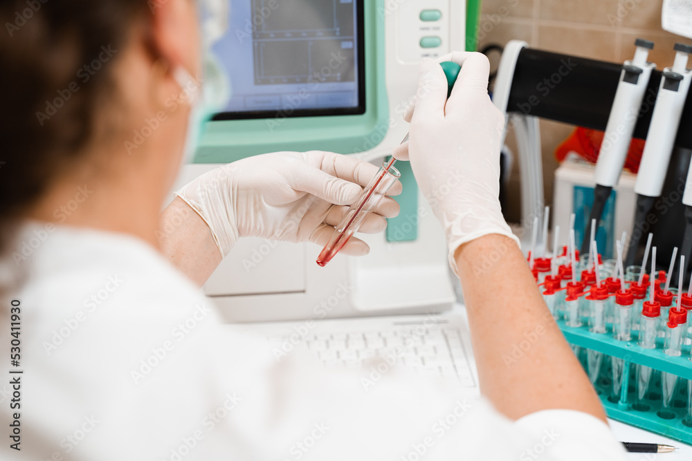 Laboratory assistant works on blood analyzer and makes hematological ...