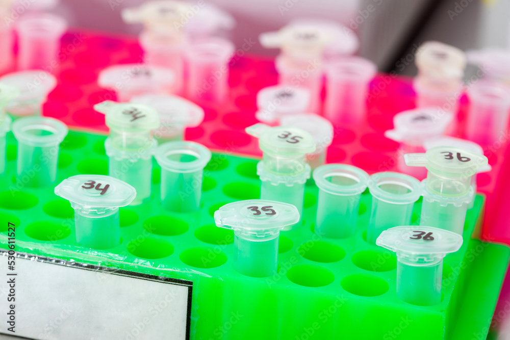 Foto de Rack of test tubes being used for DNA extraction using the spin ...