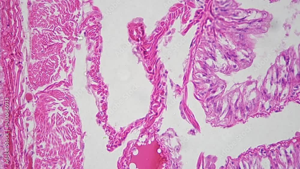 Earthworm filmed under microscope 400x in transversal section against ...