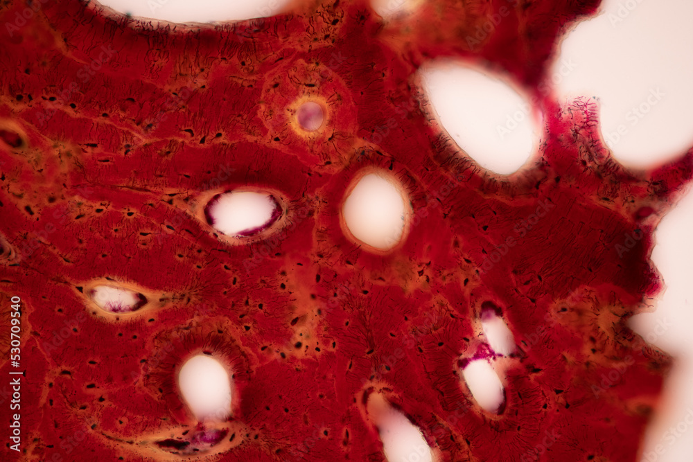 Connective tissue human and Striated muscle human under the microscope ...