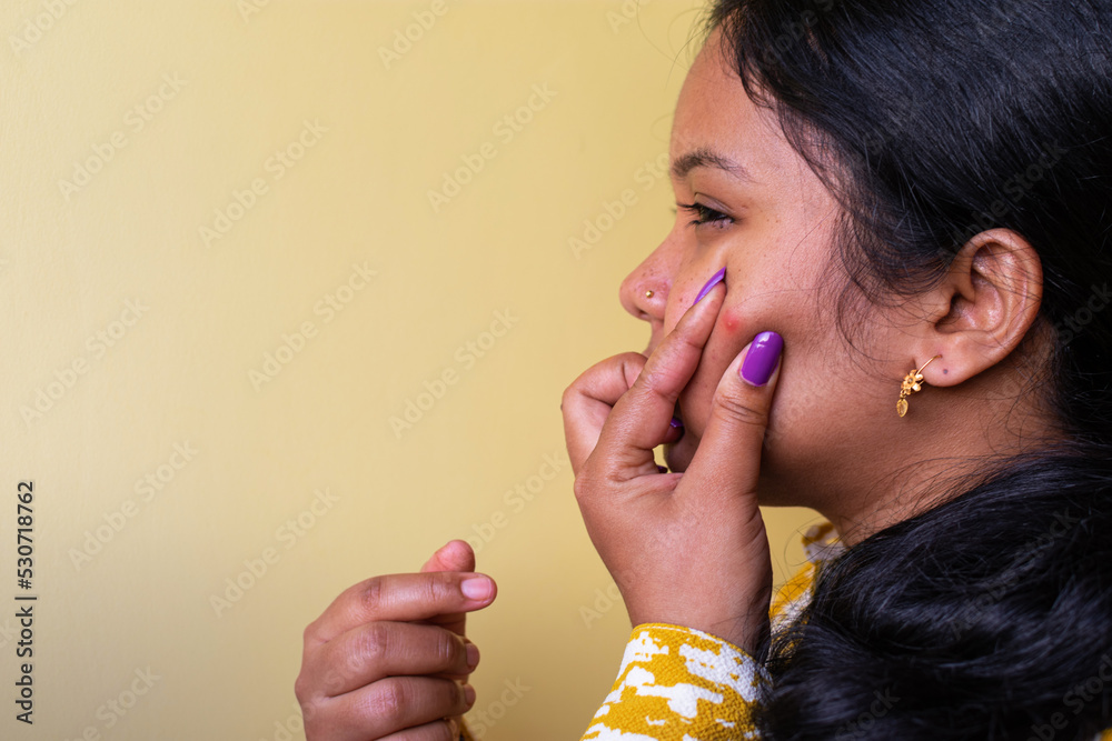 Portrait of teenage girl squeeze acne on her cheek, shot in the bedroom ...