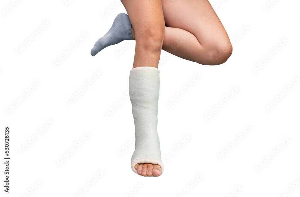 Broken leg. Ankle and foot splint Bandages on the legs on isolated ...