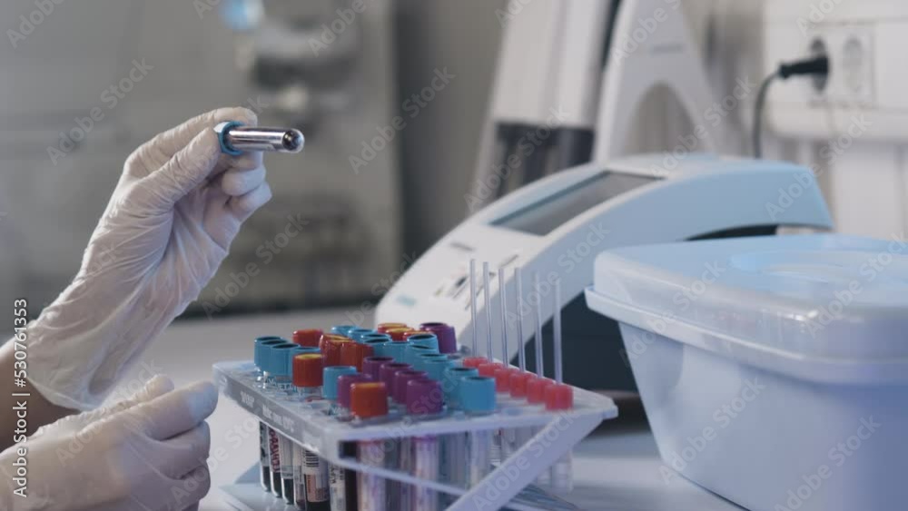Close-up of the Hand in Glove Taking Test Tube With Blood Samples ...