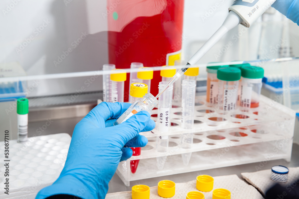 Scientist preparing blood samples for karyotipe and fluorescence in ...