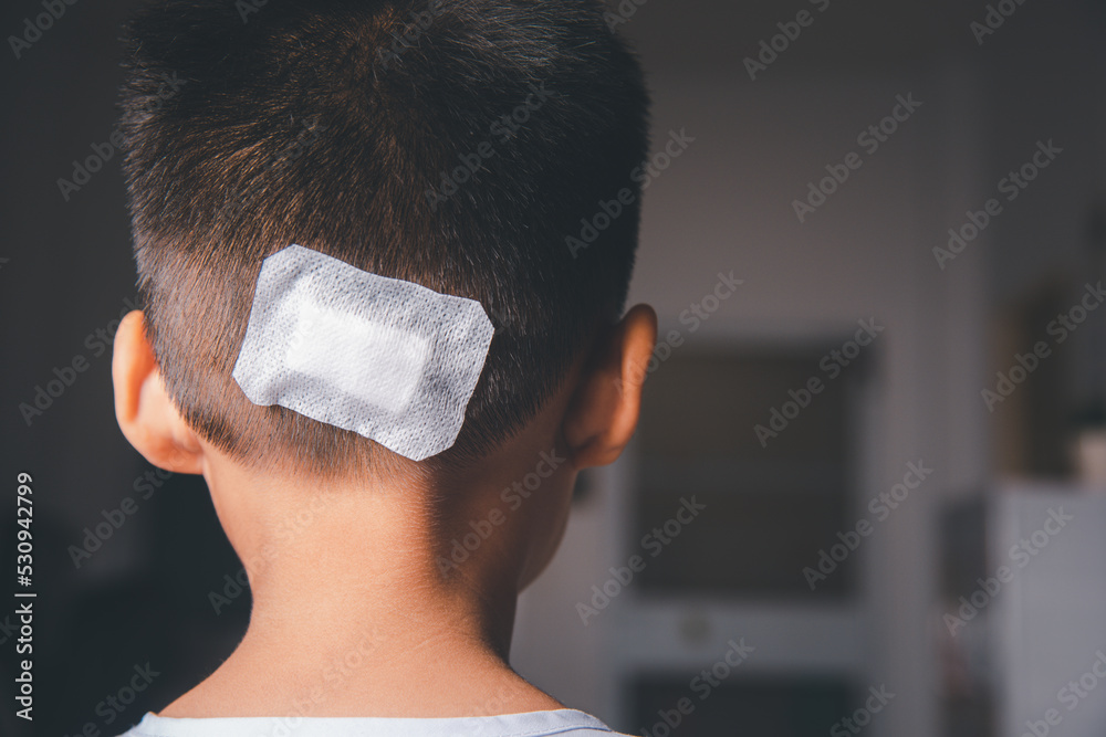The lacerated suture wound of kid back head which suture with trauma ...