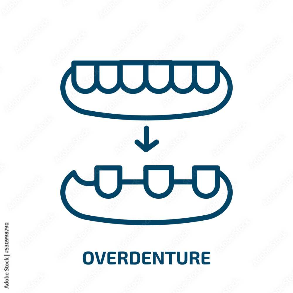 overdenture icon from dentist collection. Thin linear overdenture ...
