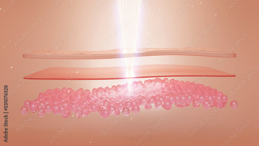 Hifu laser shot on skin cell through deep to SMAS layer. 3D rendering ...