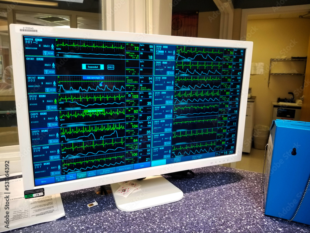 Ekg Monitor Screen