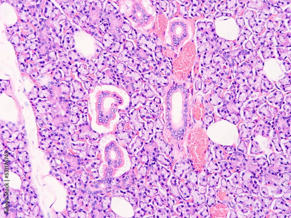 Histology of human tissue, show epithelial tissue and connective tissue ...
