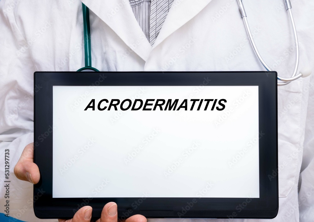 Acrodermatitis. Doctor with rare or orphan disease text on tablet ...