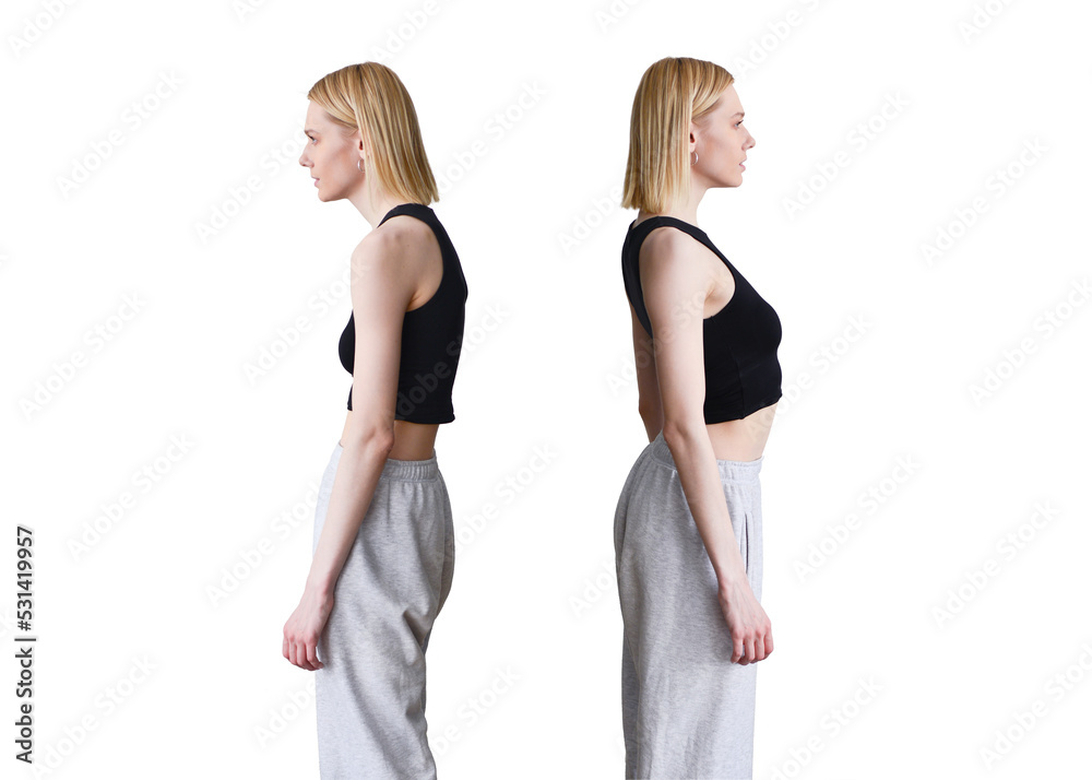 Comparison of bad and good posture. Woman slouching and straightening ...