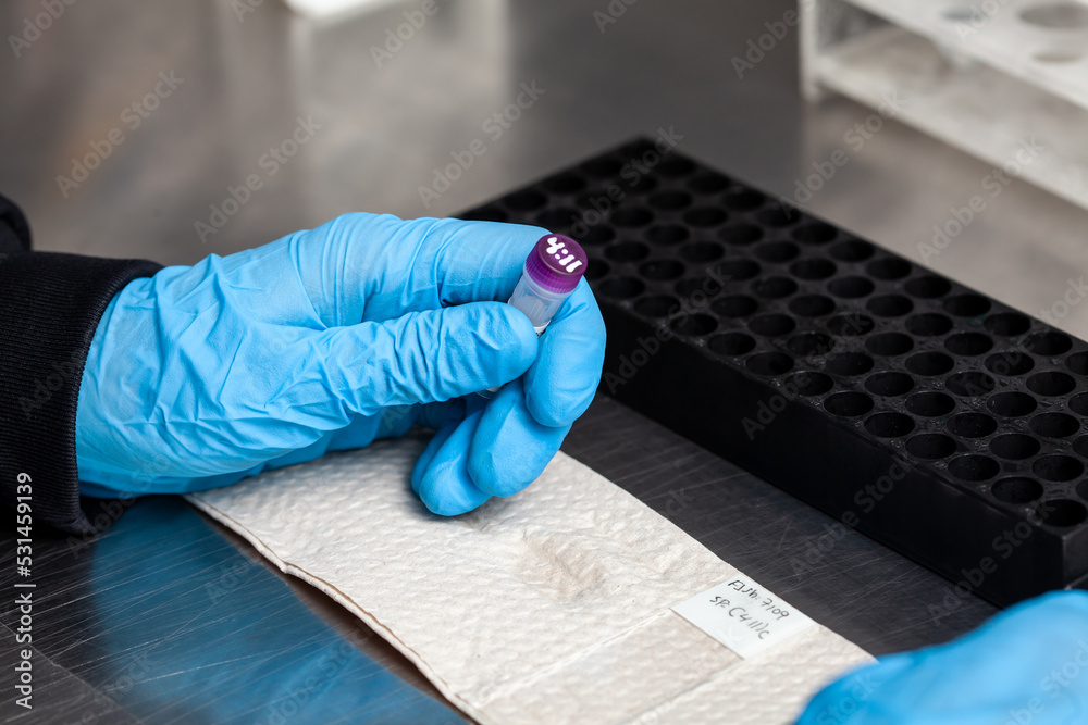 Scientist preparing slides for karyotipe and fluorescence in situ ...