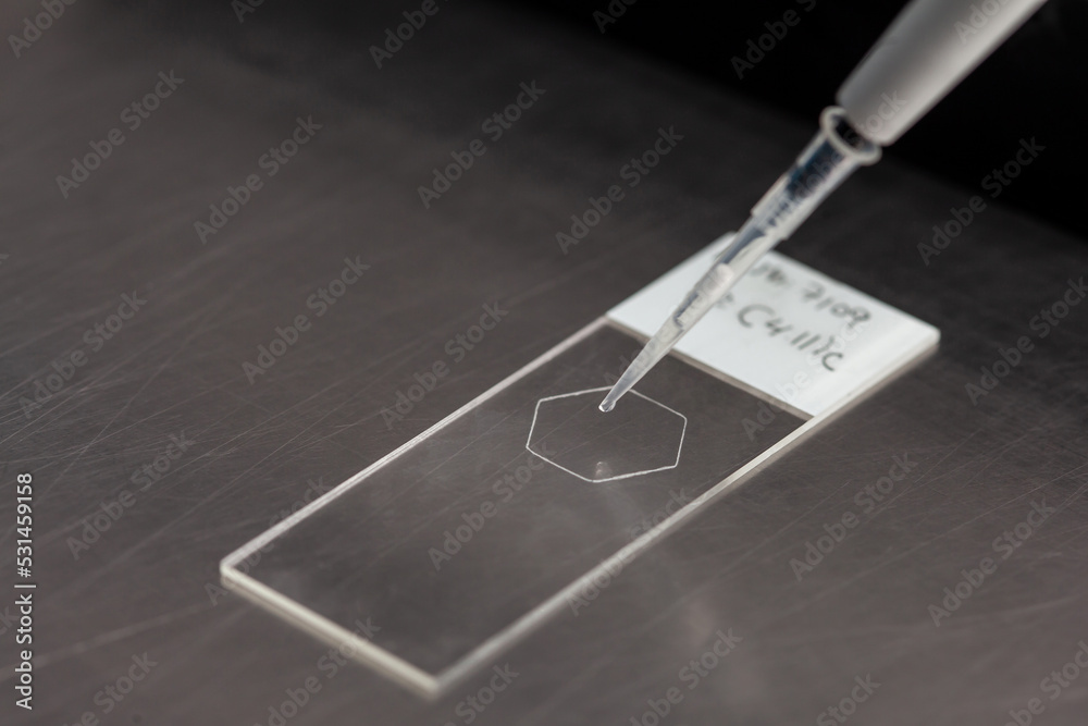 Scientist preparing slides for karyotipe and fluorescence in situ ...