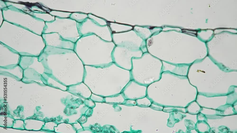 Frond of Marchantia section under magnified under microscope in 400 ...