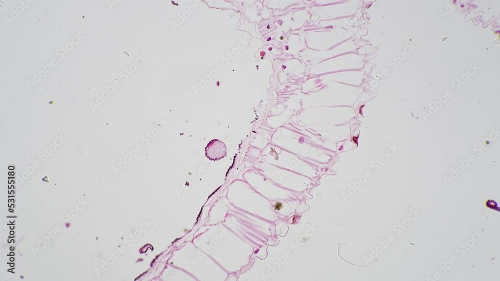 Matuer anther of Lilium in transversal section under microscope 100x on ...