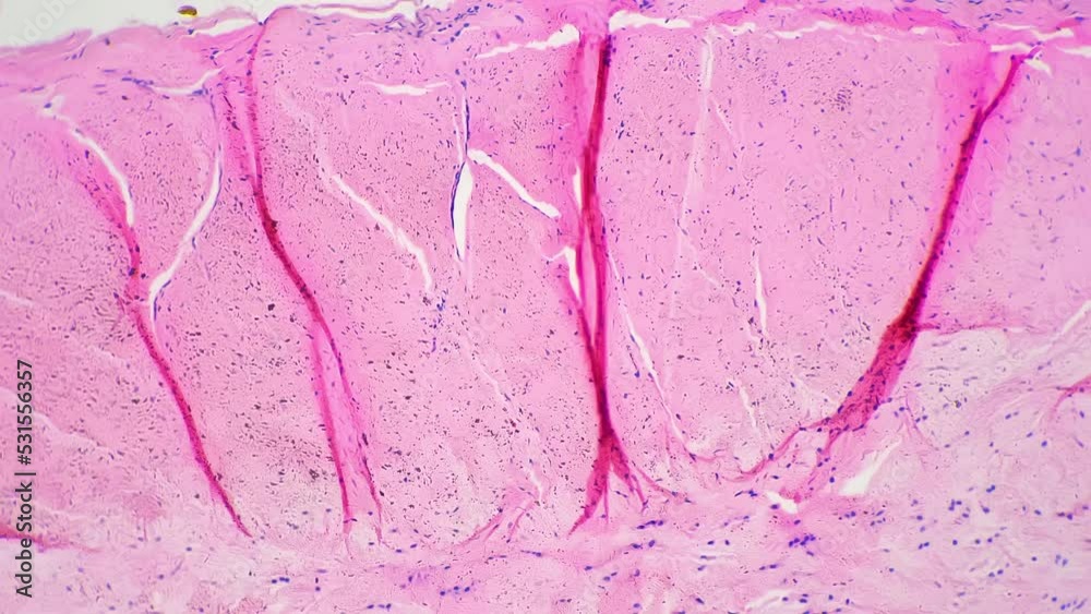 Dense connective tissue in longitudinal section under microscope 100x ...