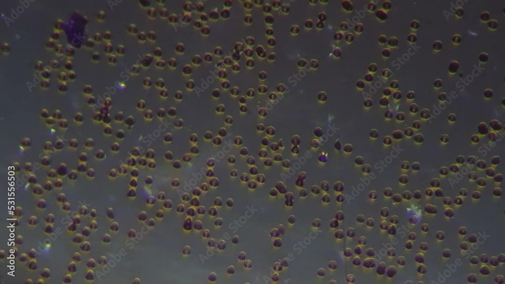 Blood of human smear filmed with oblique illumination under microscope ...