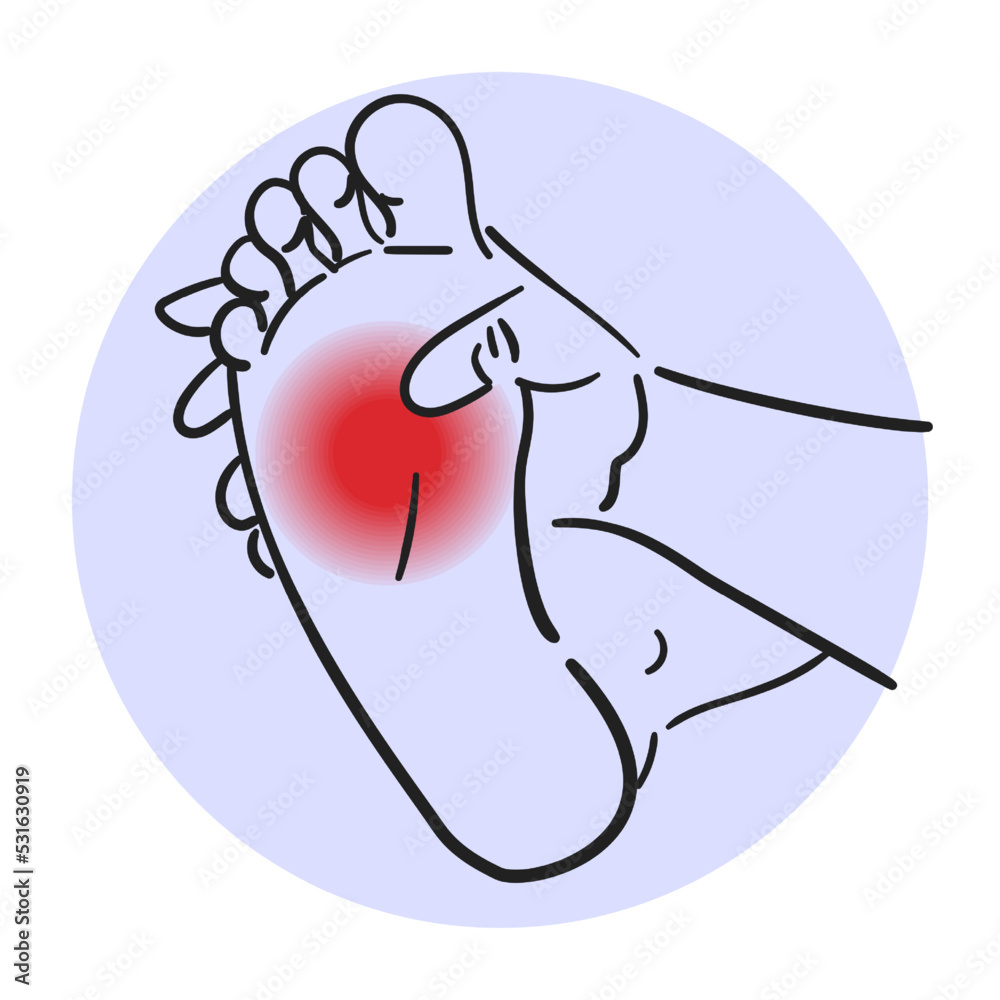 Foot pain vector isolated. Medical illustration, physical injury ...