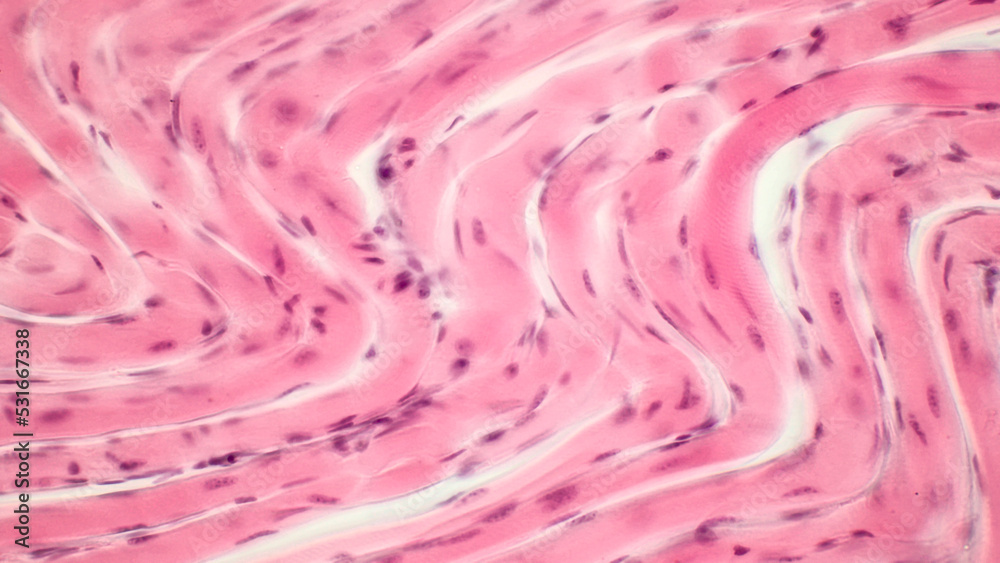 Light micrograph of a section through skeletal muscle. Muscle fibre ...